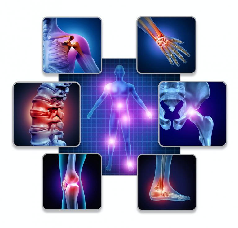 Musculoskeletal Physiotherapy in Singapore | Rapid Physiocare