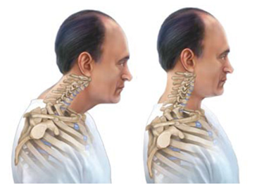 The Awkward Neck; What can help with my pain? - Rapid Physiocare