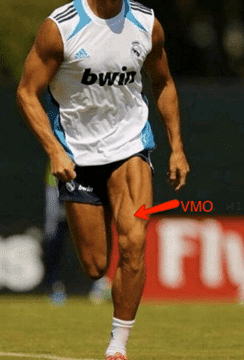 How to Fix Sore Knees with Exercise! - Rapid Physiocare