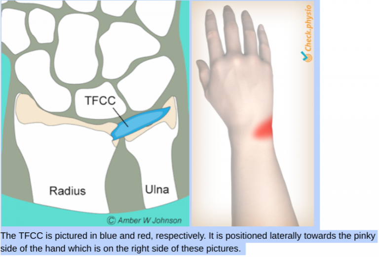 Bouldering Better: A Guide To Managing Wrist Pain